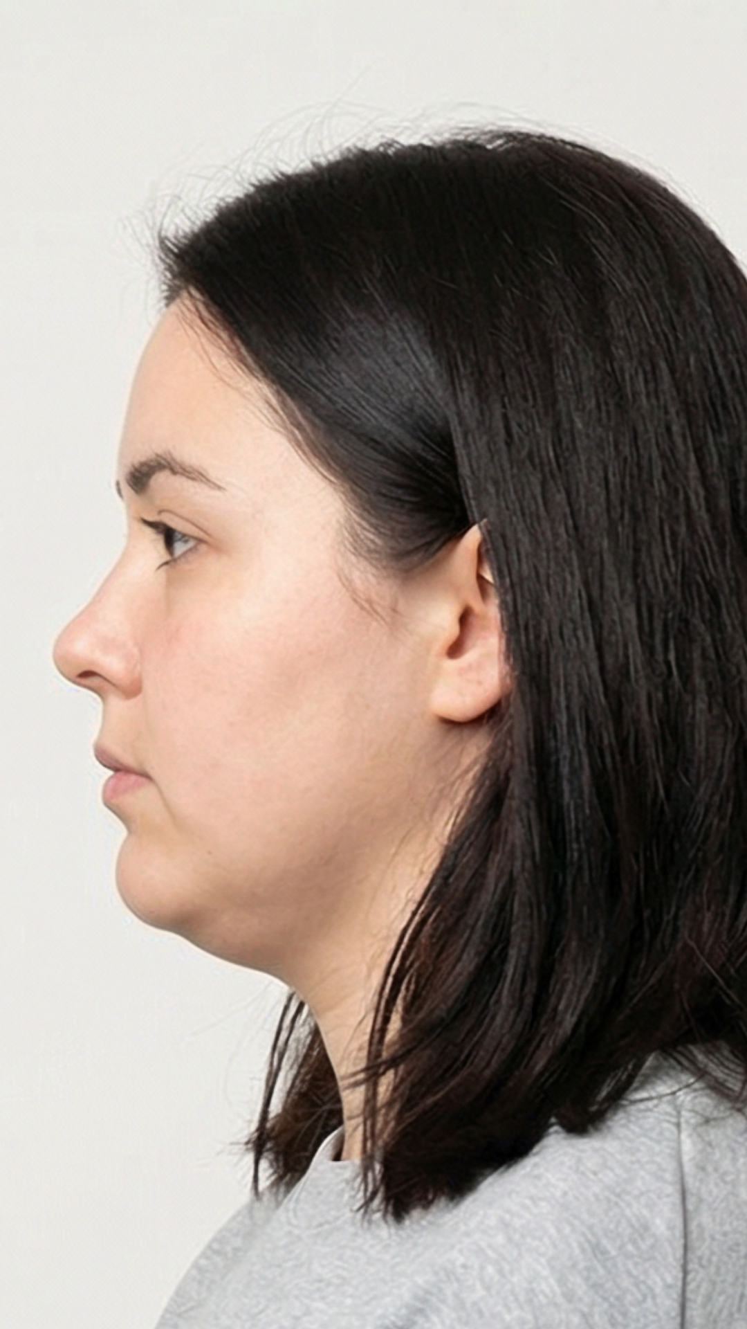 Skin Care Patches – Sniggo